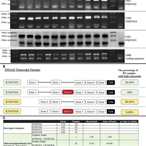 Rt Pcr Amplification Of Tsga10 Transcript Variants A 1500ng Of