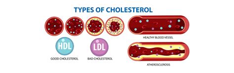 Understanding Cholesterol Medicare Plus Inc