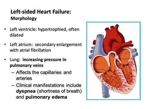 Systemic Lecture 15 Flashcards Quizlet