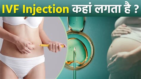 IVF Injection Kaha Lagta Hai IVF Injection Side Effects IVF Ke