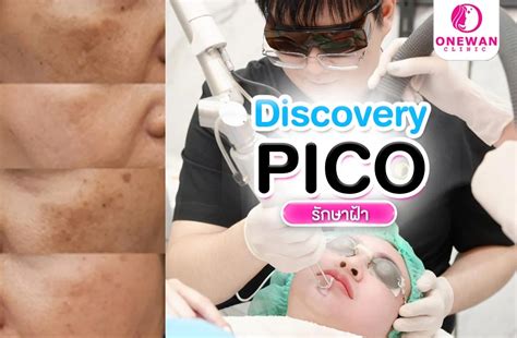 Discovery Pico ฝ้า
