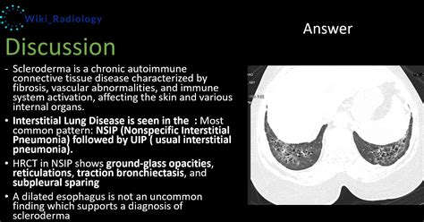 Wikiradiology Wikiradiology Added A New Photo Wikiradiology Wikiradiology Added A New Photo