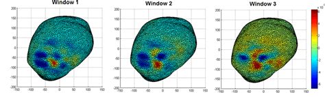 20 Ehg Source Imaging Using Svb Sccd Inverse Method Of Pregnant Download Scientific Diagram