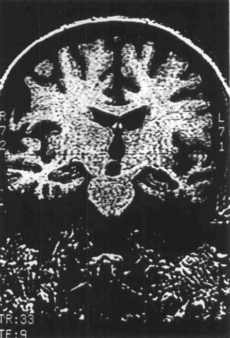 Paired Associate Learning Number Of Trials And Number Of Correct Download Scientific Diagram