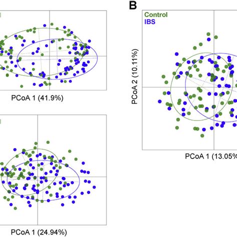 comparison of control and ibs urine and fecal metabolomes a pcoa of