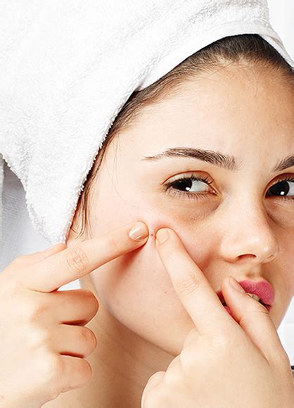 Products Active Ingredients Anti Acne