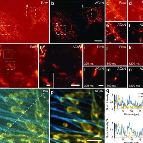 Pdf Fast And Accurate Scmos Noise Correction For Fluorescence Microscopy