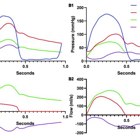 Distribution Of Baseline PAPI PAPI Pulmonary Artery Pulsatility Index Download Scientific