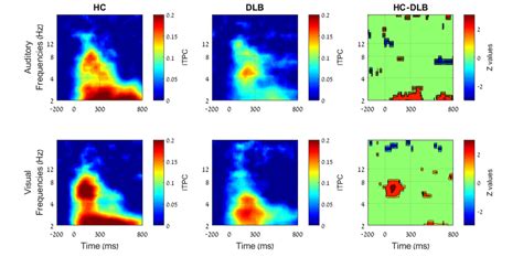 4 Time Frequency Maps Of Inter Trial Phase Clustering For Auditory And