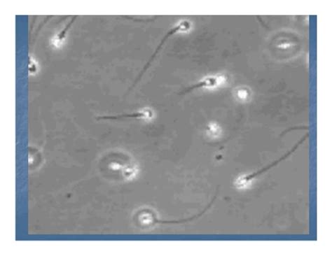 Semen Analysis Lab Ppt Compatibility Mode Pptx