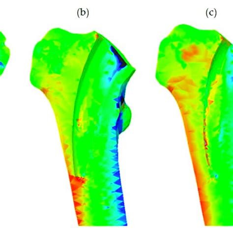 A Comparison Of The Absolute Maximum Principal Strain Distribution Download Scientific