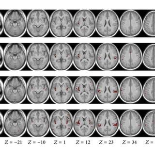 Functional Connectivity Maps Of The Stimulated Areas Connectivity Maps Download Scientific