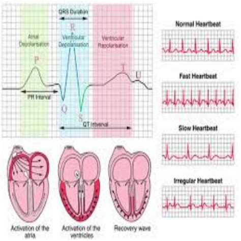 Ekg Ecg Interpretation Basic And Advanced Strips Easy And Simple 130