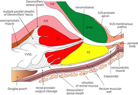 Complete Puborectalis Puboperinealis Muscle And Urethral