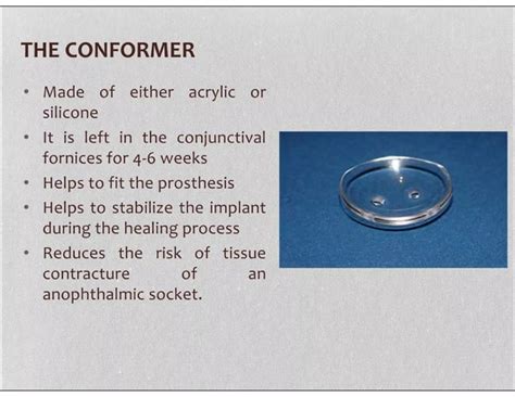 Eye Prosthesis And Rehabilitationpdf