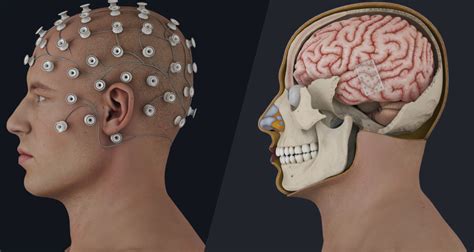 Brain Computer Interface