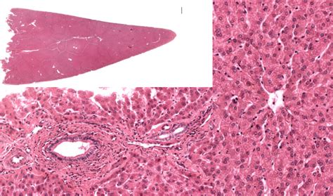 Liver Diagram Quizlet