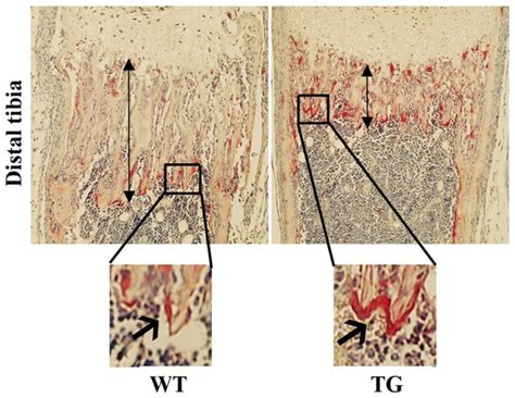 Tibia From Wild Type Wt And Transgenic Mice Tg Were Histologically