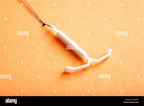 Iud Birth Control