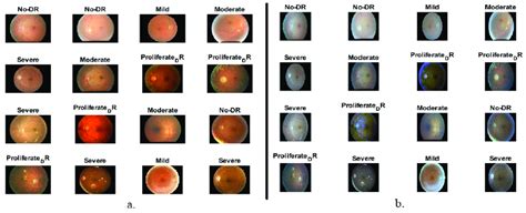 A Set Of Fundus Image Samples A Before Enhancement Set Of Data Set Download Scientific