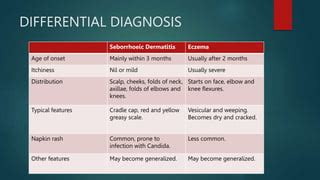 Atopic Dermatitis Diagnosis Andmanagement Pptx