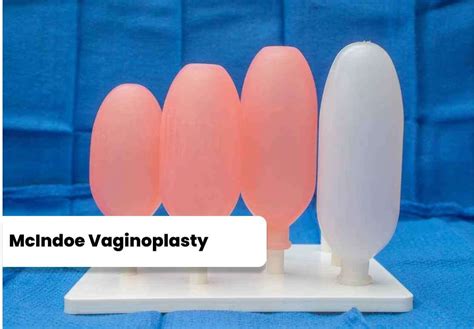 Vaginoplasty Surgery Procedure Cost And Transgender Options Doctorsapp