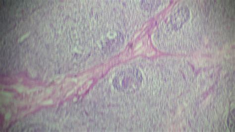 14 Cross Section Of A Lymph Node Stock Videos Footage And 4k Video Clips Getty Images