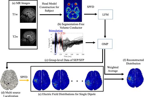 High Resolution Eeg Source Localization In Personalized Segmentation