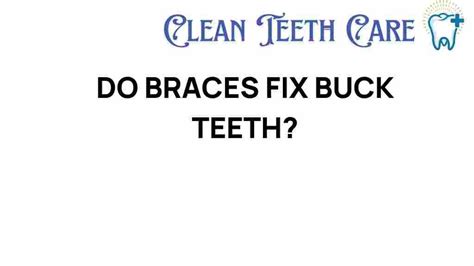 Unlocking The Mystery Do Braces Truly Fix Buck Teeth