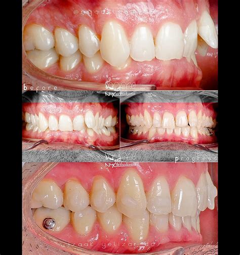 Our Work Advanced Orthodontic Photos
