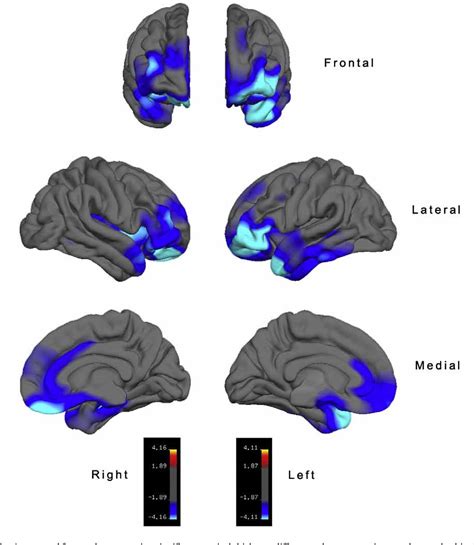 PDF Investigating Relationships Between Cortical Thickness And Cognitive Performance In