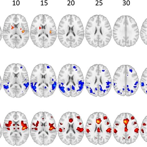 brain activity associated with task effect and intensity rating