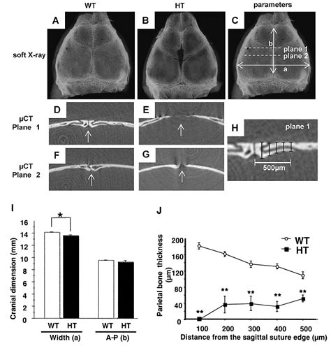 Narrow Cranium With Reduced Parietal Bone Thickness In Adult Runx2 Download Scientific Diagram