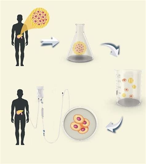 Islet Cell Isolation Cell2cure