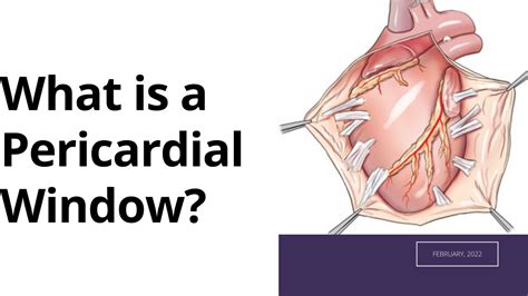 What Is Pericardial Window Daily Care Blog