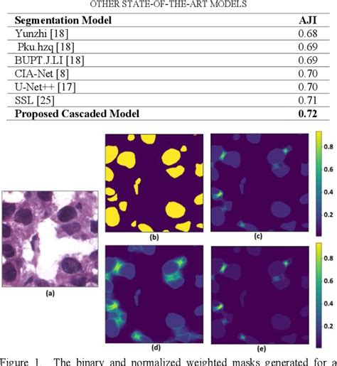 Figure 1 From A Cascaded Deep Learning Framework For Segmentation Of