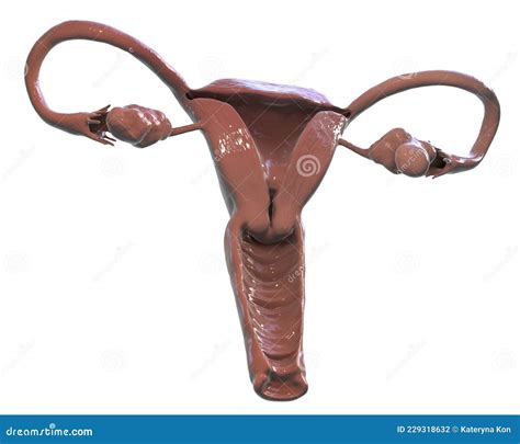Polycystic Ovary Syndrome Stock Illustration Illustration Of Woman