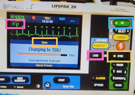 Synchronized Cardioversion Cpr Done Right Cpr Acls Bls Pals Nrp Courses