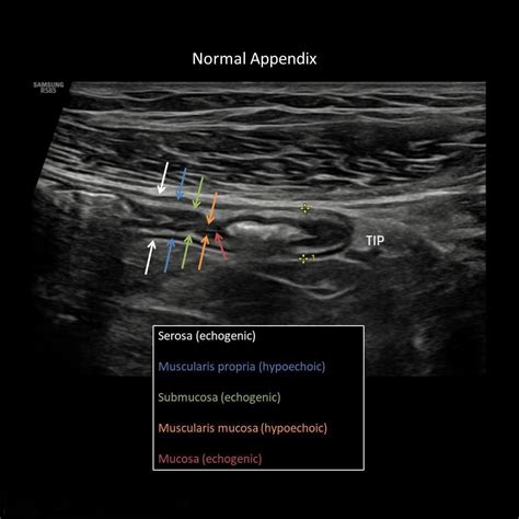 Radiology Interesting