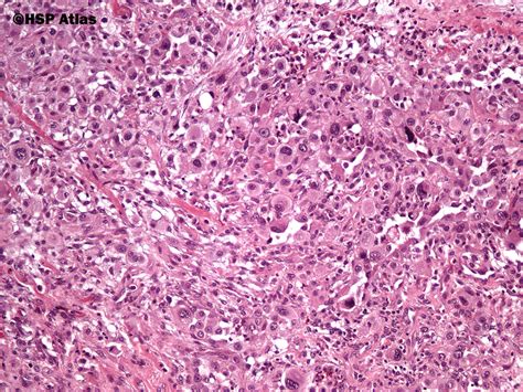 Hsp Atlas Histopathology Atlas Heart And Vessels