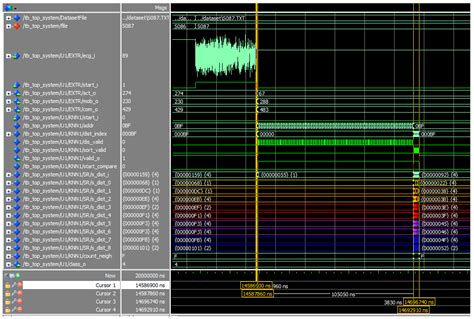 Fpga Based Implementation For Real Time Epileptic Eeg Classification