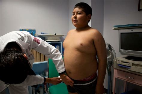 Статистика ожирения причины и последствия избыточного веса