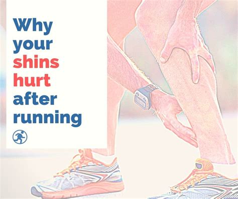 Shin Splints