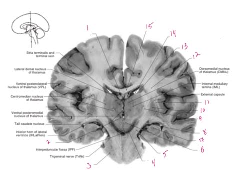 Anatomy Brain Slices Flashcards Quizlet