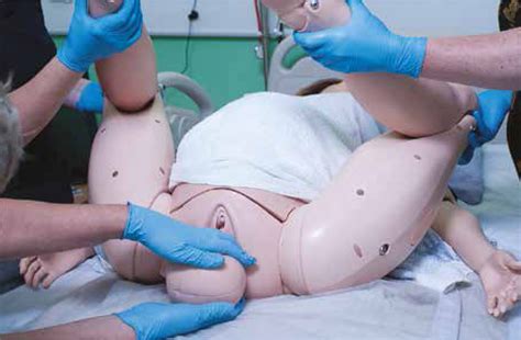 British Journal Of Midwifery Management Of Shoulder Dystocia Using