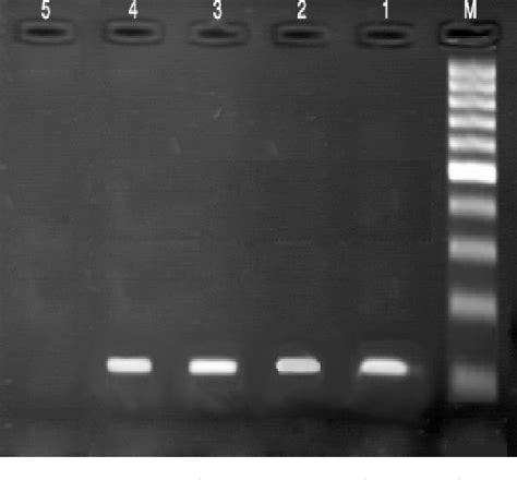 Figure 1 From Molecular Assessment Of Clarithromycin Resistant Helicobacter Pylori Strains Using