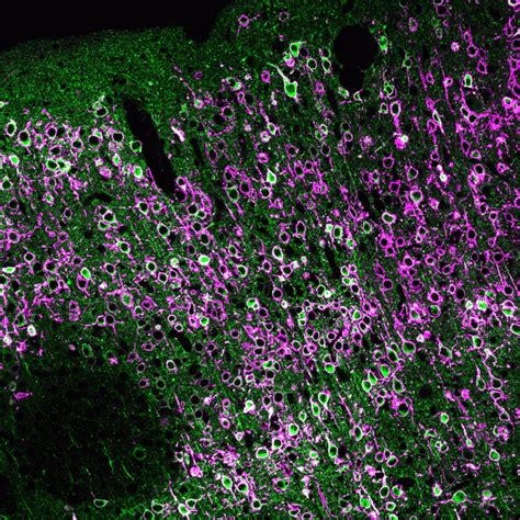 Refining Optogenetic Methods To Map Synaptic Connections In The Brain Max Planck Florida