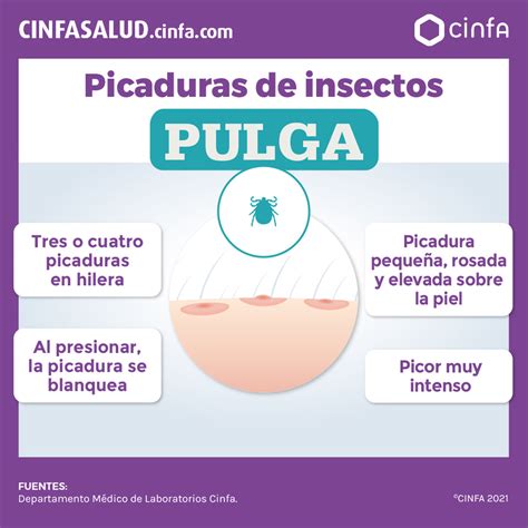 ¿cómo Prevenir La Picadura De Pulga Cinfasalud