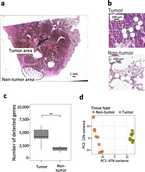 evaluation of rna seq profiling of microenvironments in lung tumor