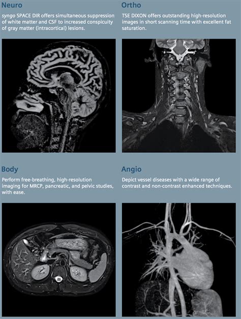 Siemens Magnetom Espree Mri Medical Outfitters